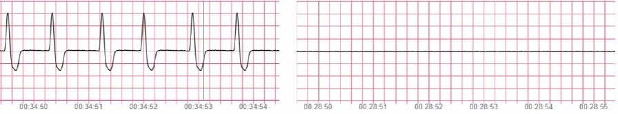 Défibrillateur : foire aux questions