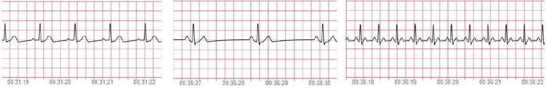 Défibrillateur : foire aux questions