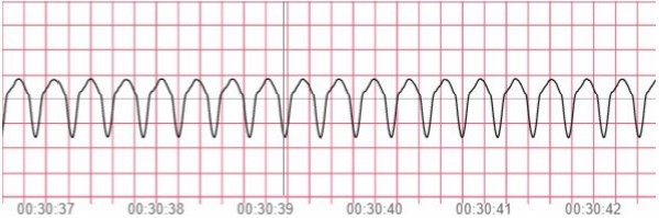 Défibrillateur : foire aux questions